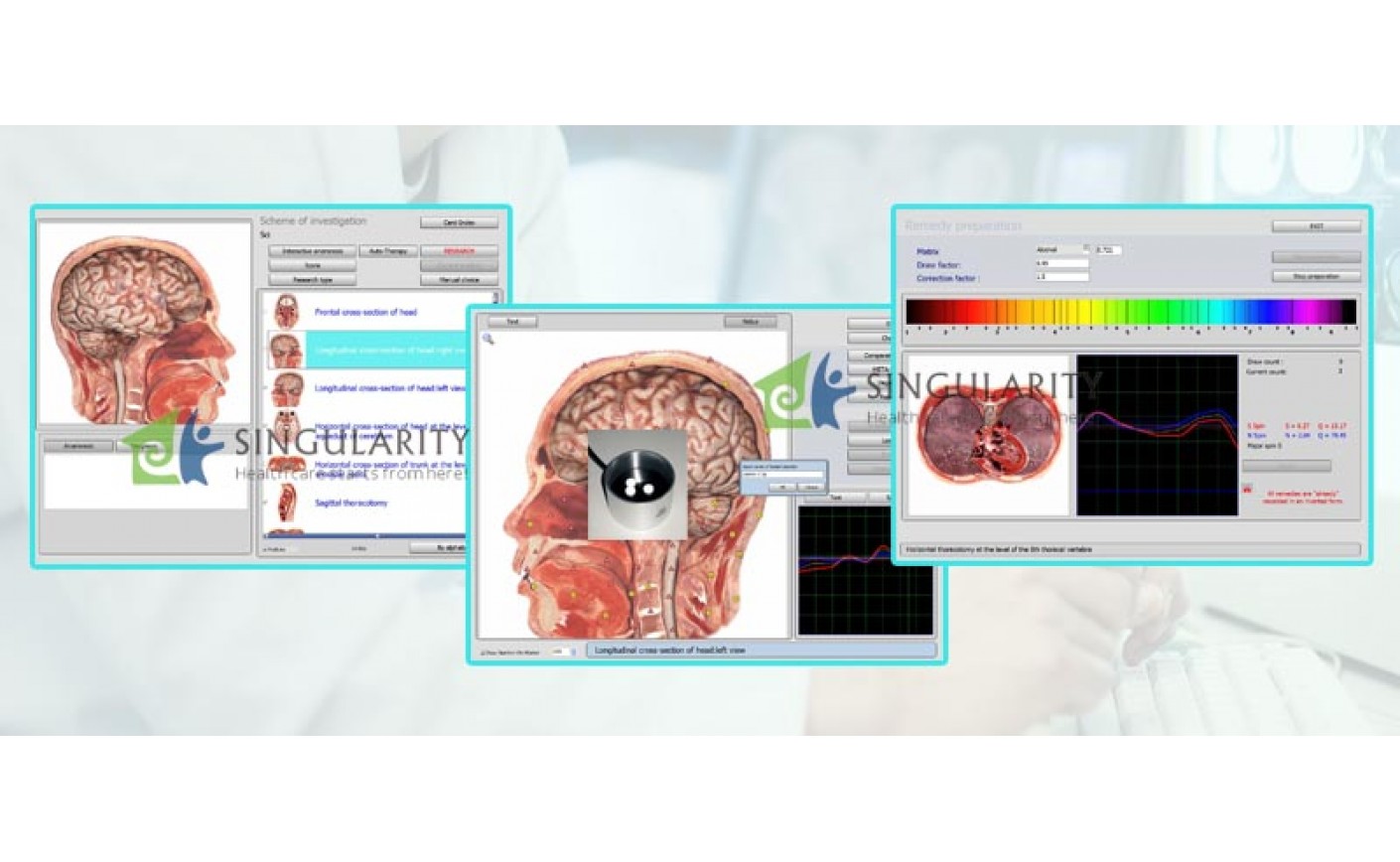 The Bioplasm NLS Health Analyzer With NLS Technology